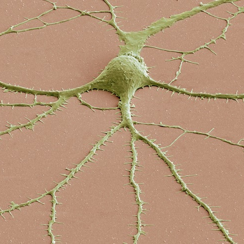 Portraits of the Mind: Brain Cells Under Microscope | Amusing Planet